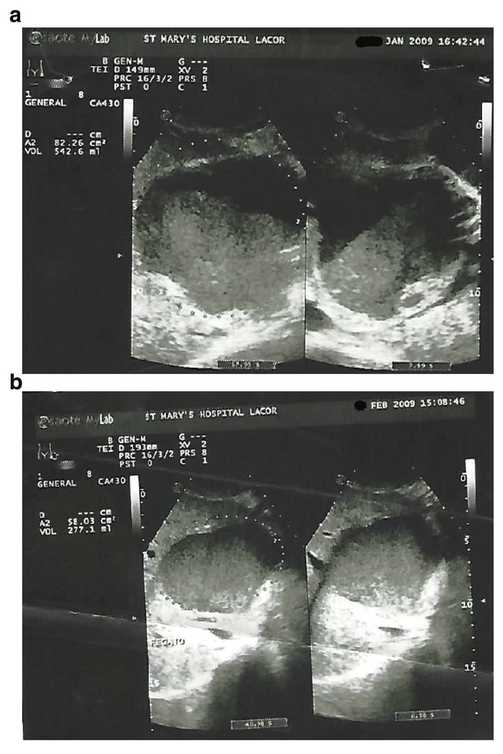 Case Report: Biloma gastrostomy after failed... | Open Research Africa